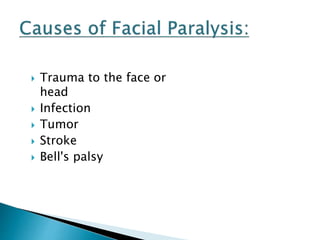 Facial Paralysis PPT.pptx