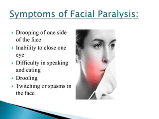 Facial Paralysis PPT.pptx