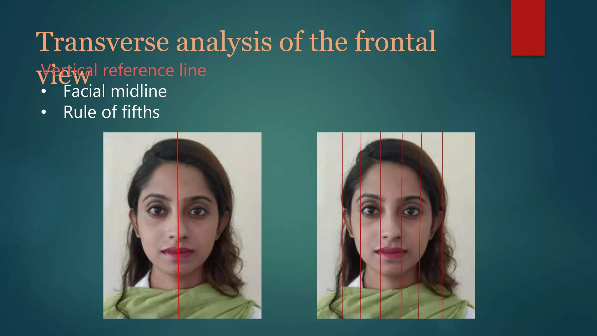 Facial photograph | PPTX