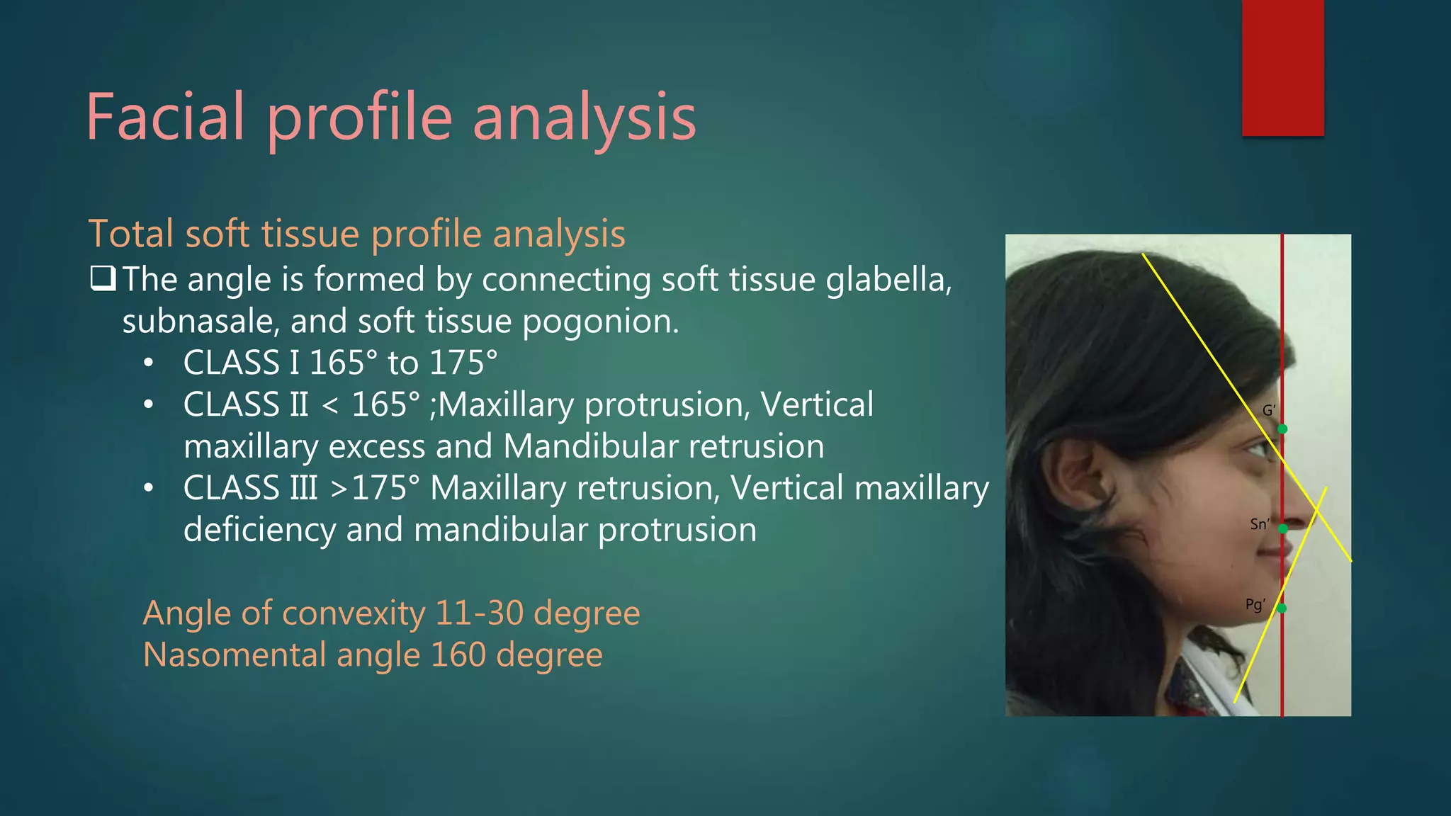 Facial photograph | PPTX
