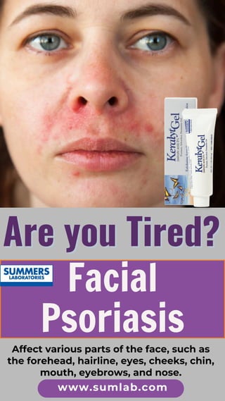 What are the first signs of psoriasis on the face? | PDF | Skin and Dermatology | Diseases and ...
