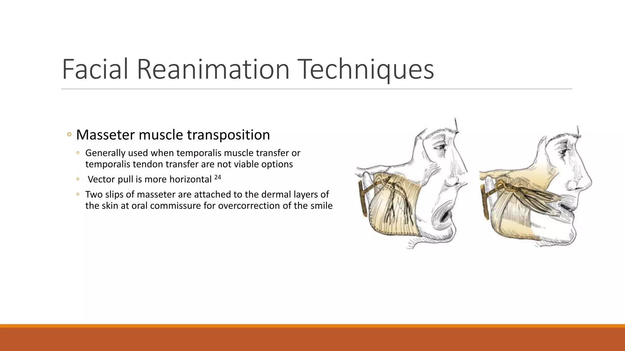 Facial reanimation | PPTX