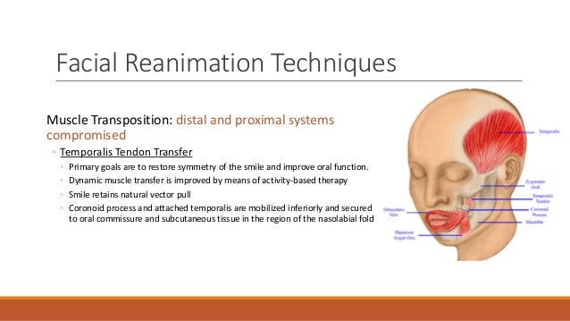 Facial reanimation nv