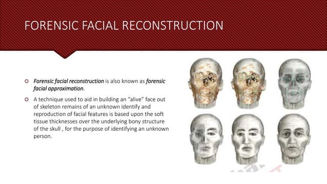 FACIAL RECONSTRUCTION by sant singh thakur.pptx