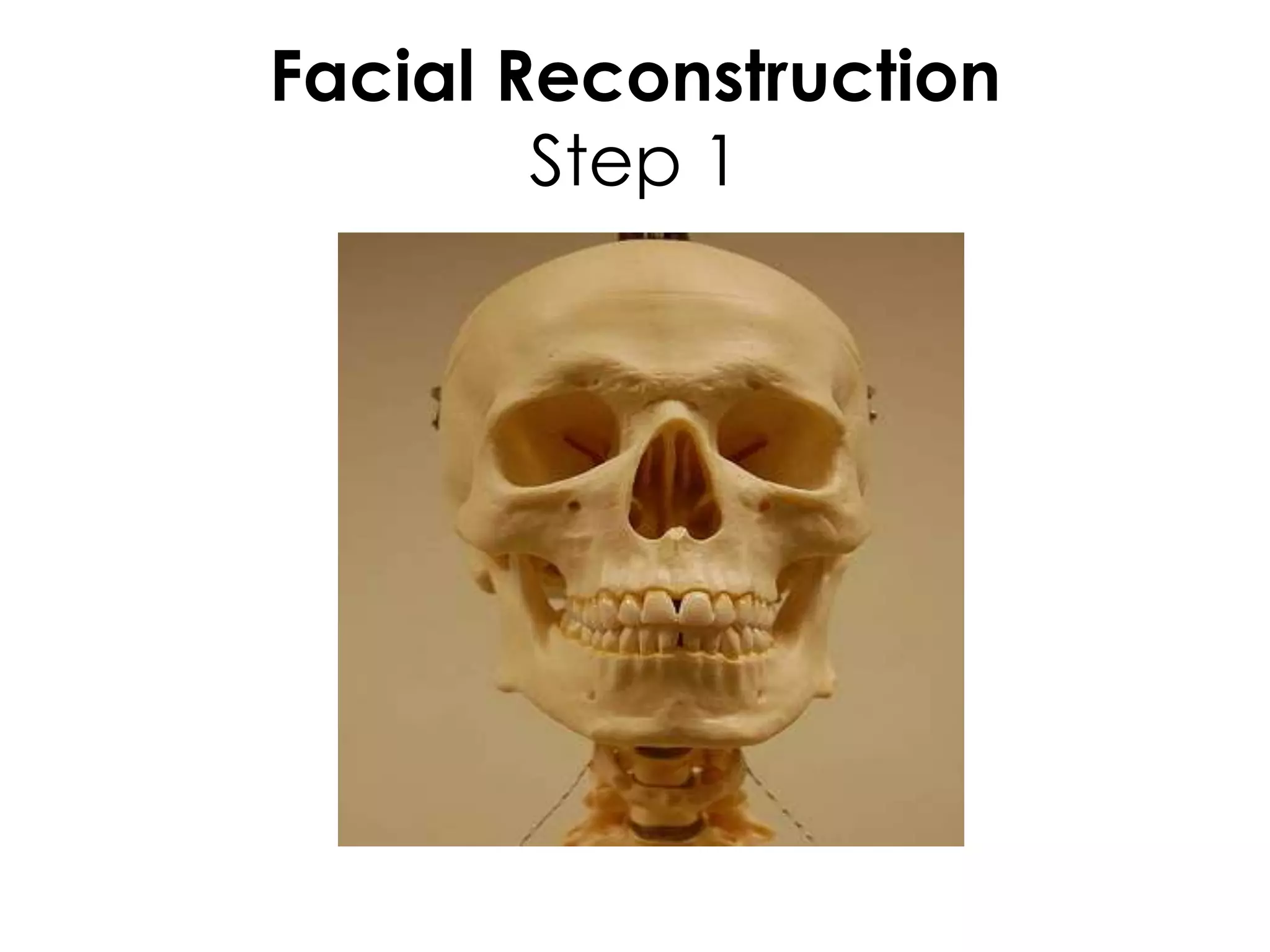 Facial reconstruction | PPTX
