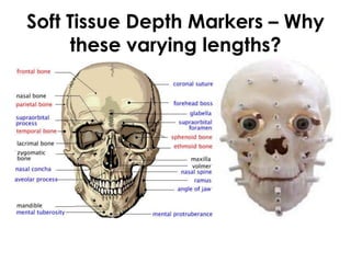 Facial reconstruction | PPT