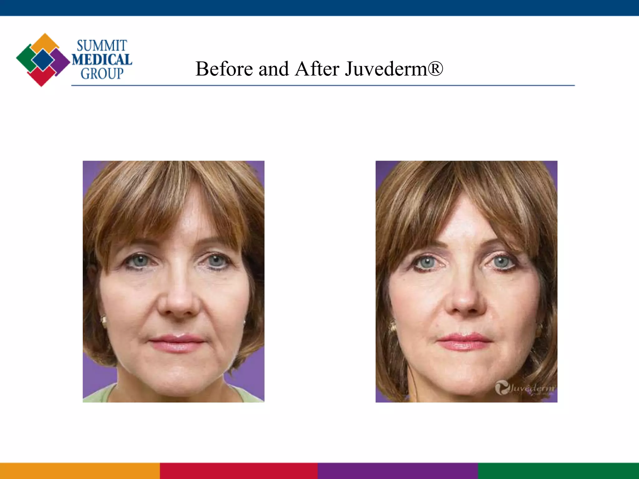 Minimally Invasive Techniques In Facial Rejuvenation | PPTX