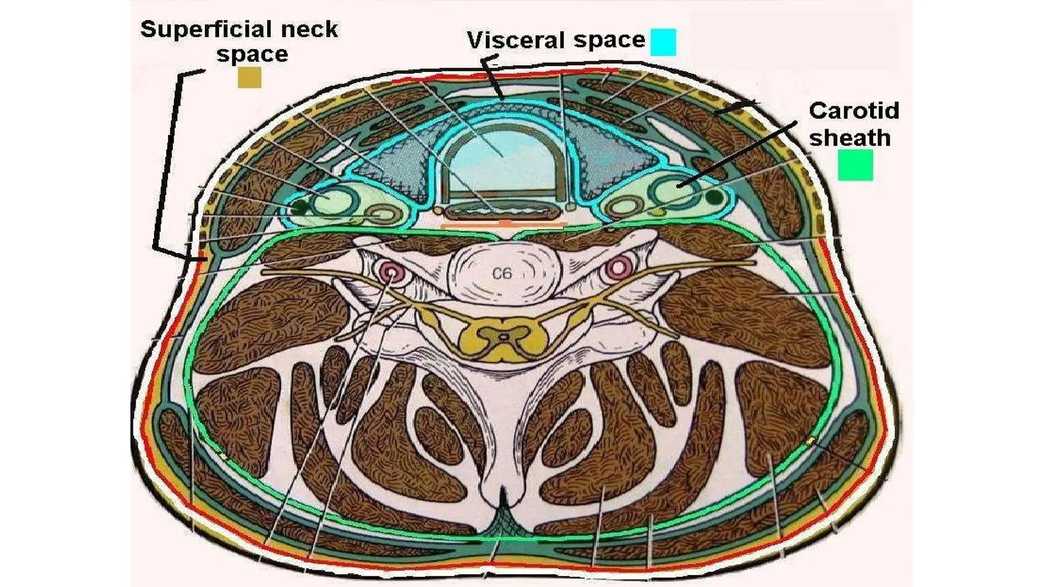 Facial Spaces and Odontogenic infections of head 2nd yr.pptx