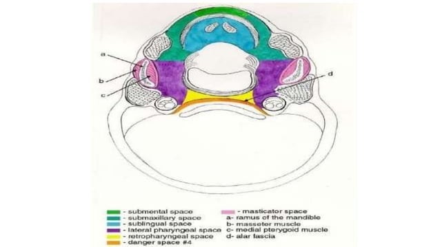 Facial Spaces and Odontogenic infections of head 2nd yr.pptx | Dental ...