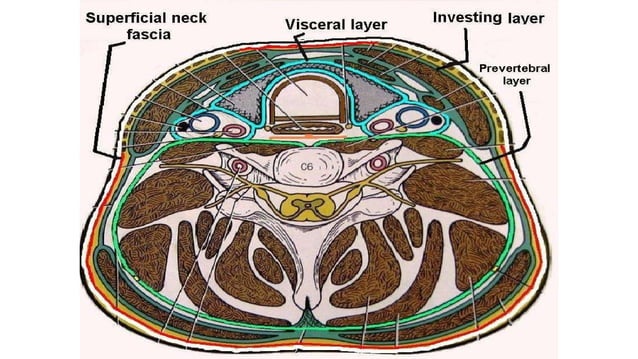Facial Spaces and Odontogenic infections of head 2nd yr.pptx | Dental ...
