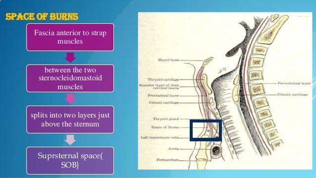 Facial spaces of periodontal interest.
