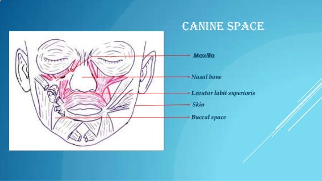 Facial spaces of periodontal interest.