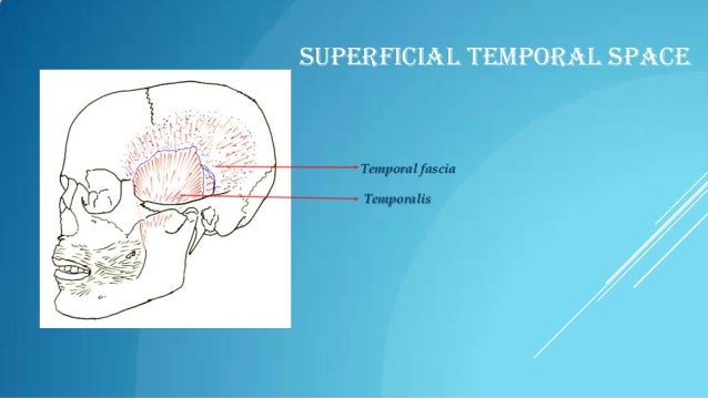 Facial spaces of periodontal interest.