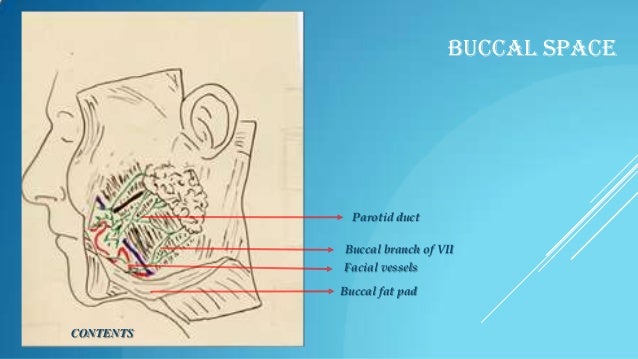 Facial spaces of periodontal interest.