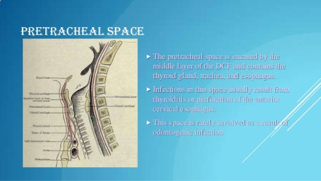 Facial spaces of periodontal interest.