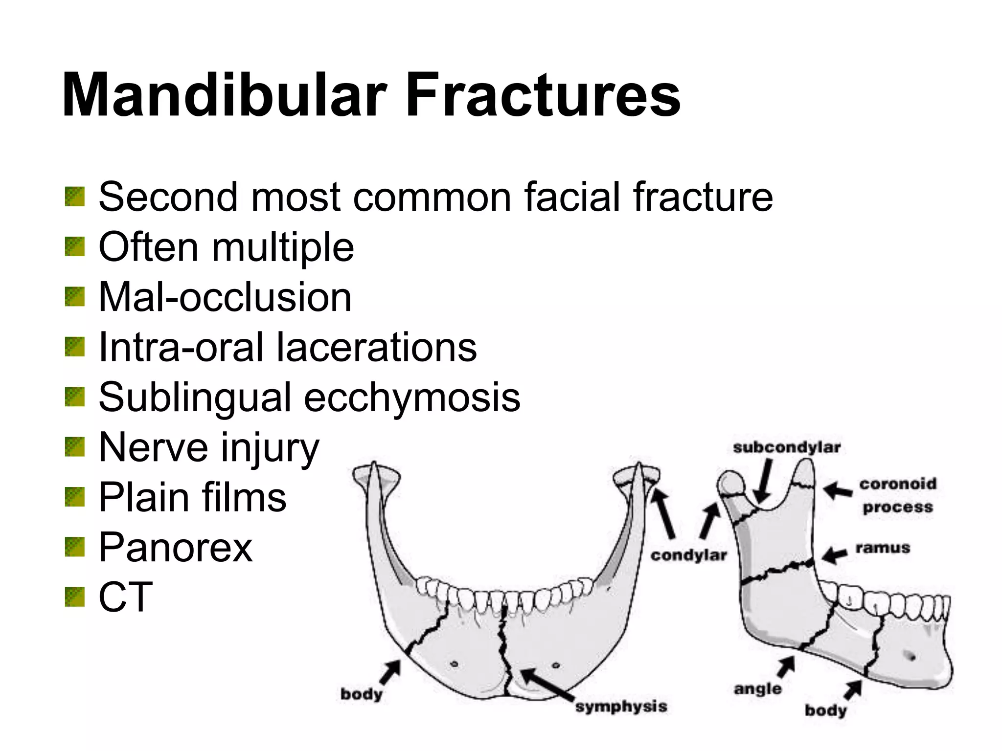 Facial Trauma | PPTX