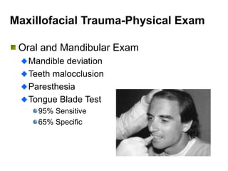 Facial Trauma | PPTX