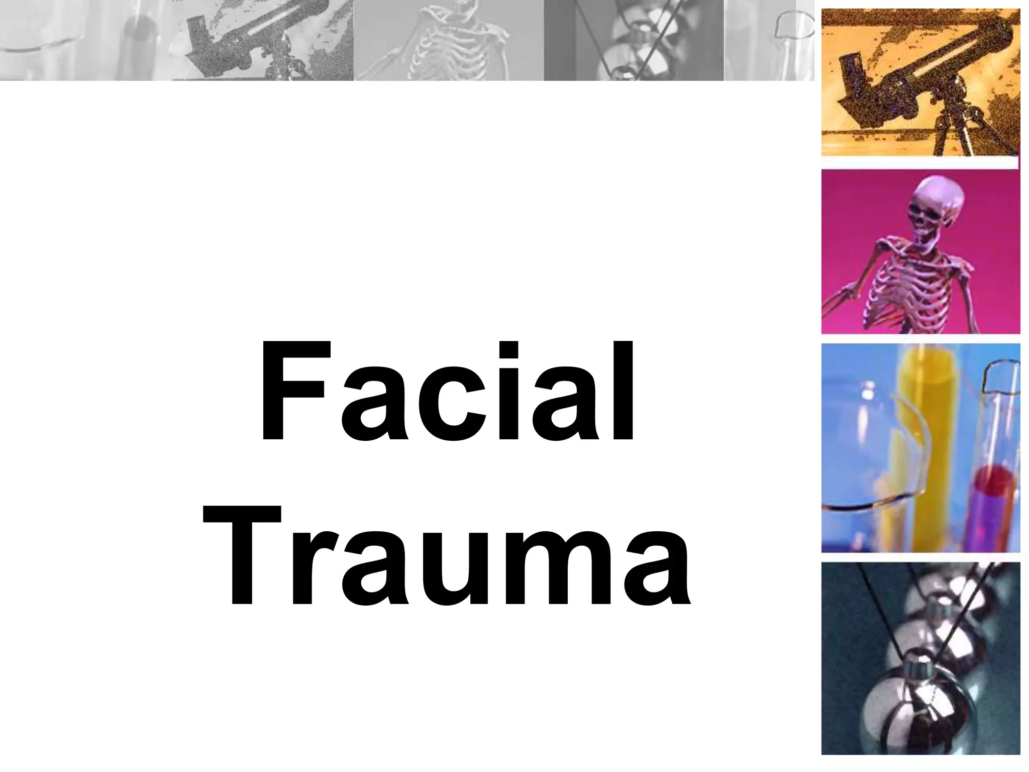 Facial trauma | PPTX