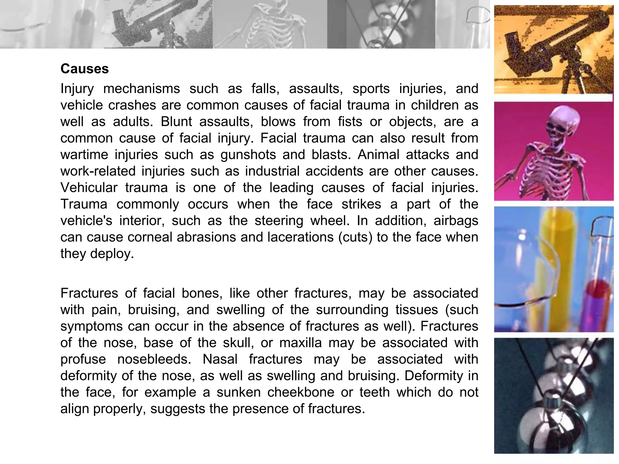 Facial trauma | PPTX