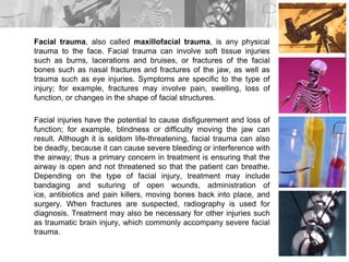 Facial trauma | PPTX