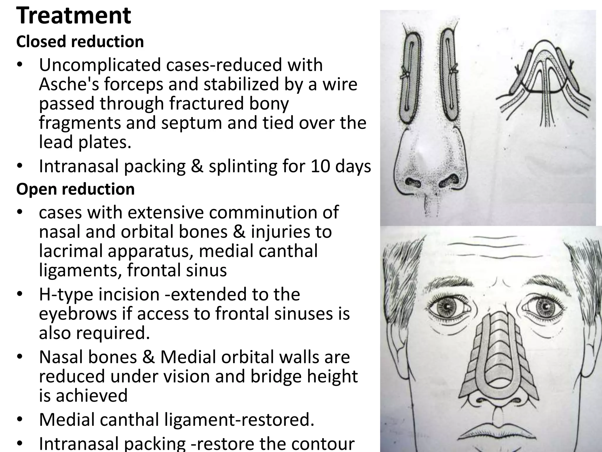 Facial trauma | PPTX