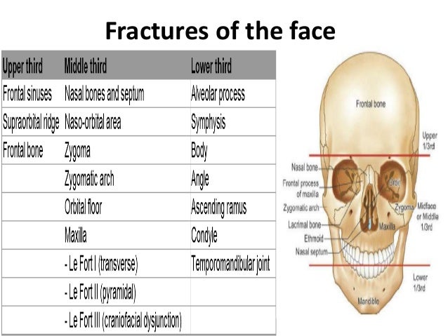 Facial trauma