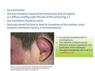 Facial trauma | PPTX