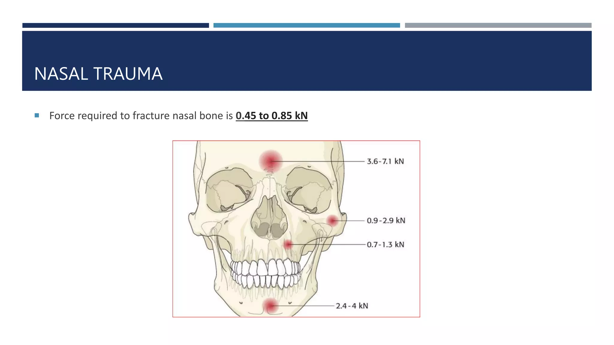Nasal Bone Fractures.pptx