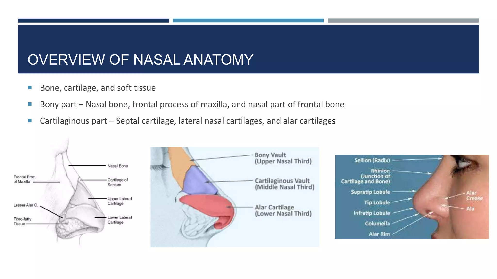 Nasal Bone Fractures.pptx