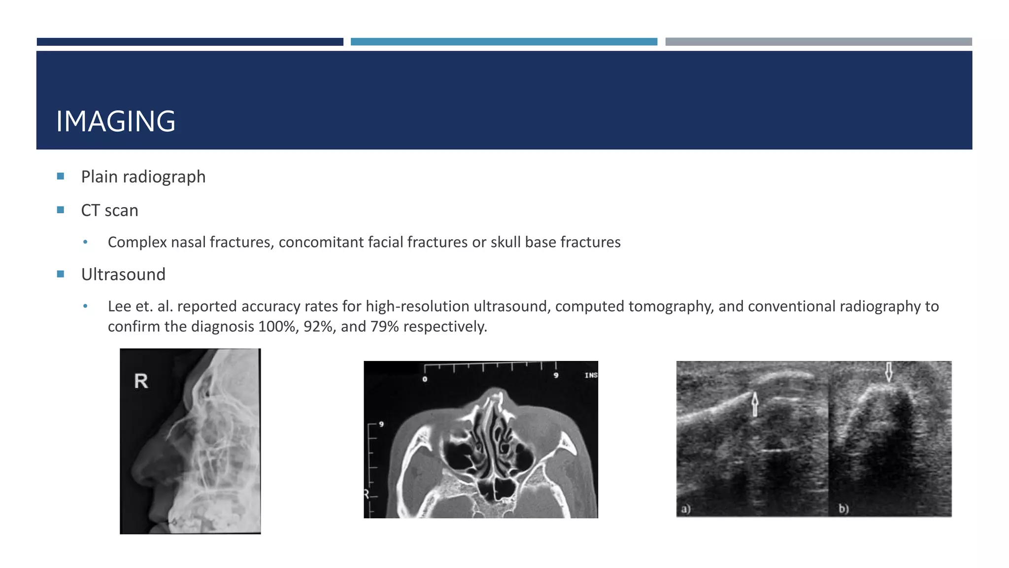 Nasal Bone Fractures.pptx
