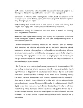 Facial Trauma Update | PDF