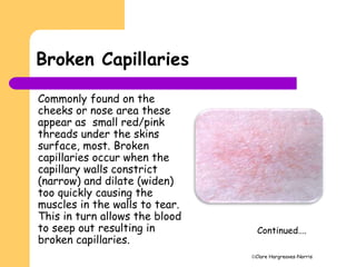 Facial types conditions | PPTX