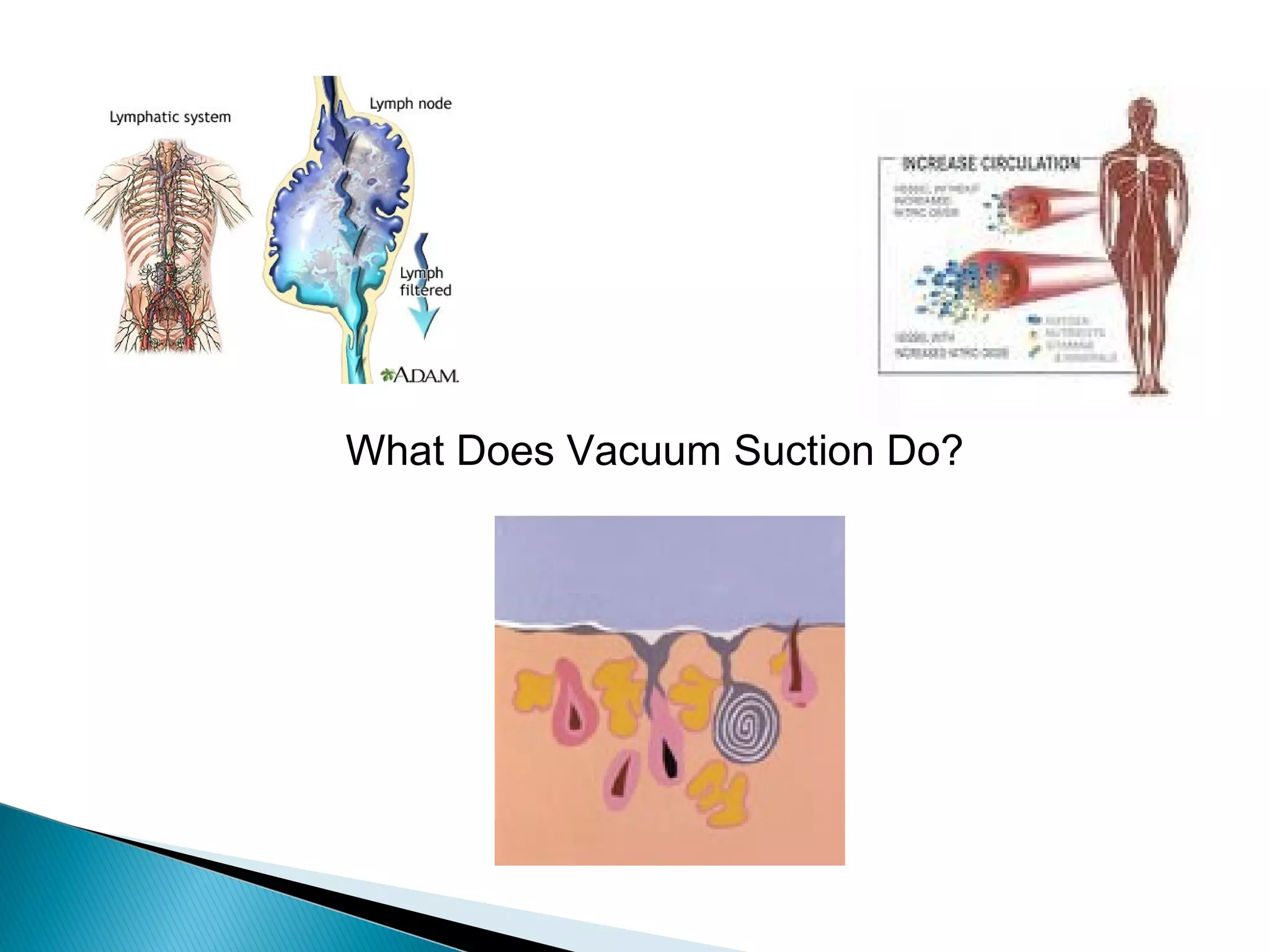 Facial vacuum suction | PPT