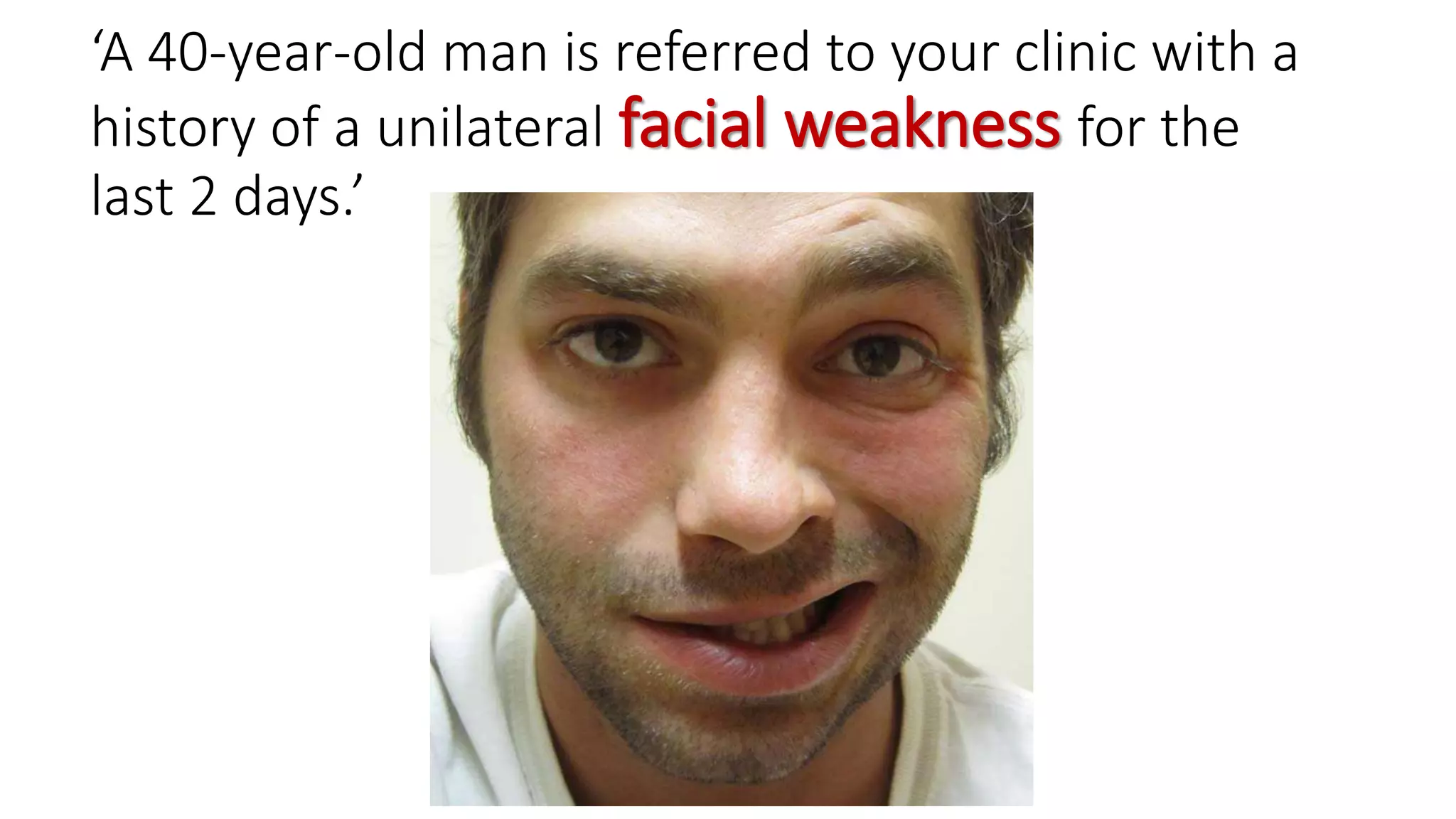 Facial weakness.pptx