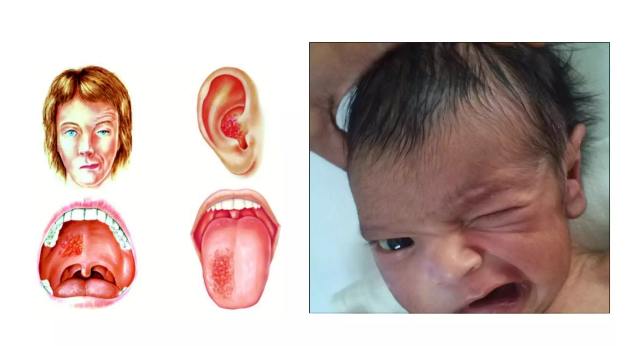 Facial weakness.pptx