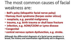 Facial weakness.pptx