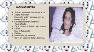 Facie caquexica | PPTX