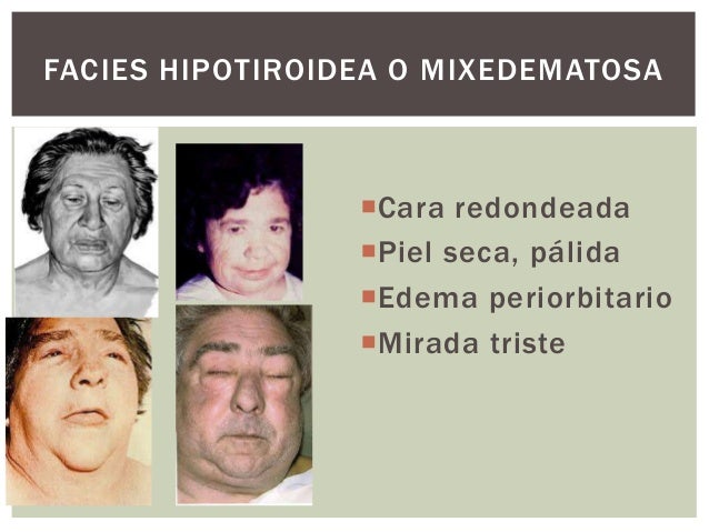 Facies