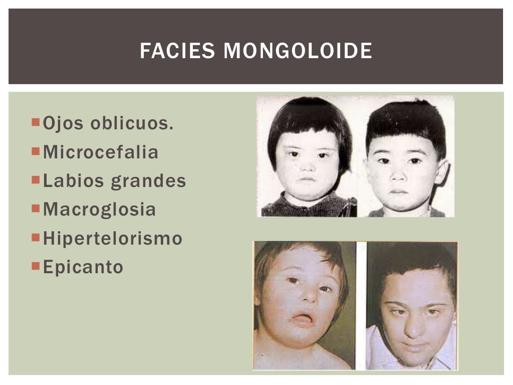 Facies Postura Y Marcha