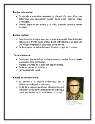 Facies | DOCX