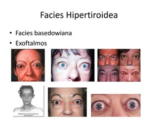 FACIES.pptx