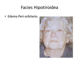 FACIES.pptx