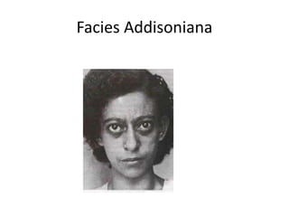 FACIES.pptx