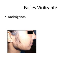 FACIES.pptx