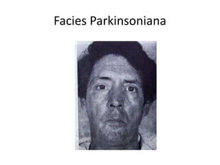 FACIES.pptx