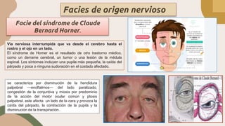 FACIES - MARCHA-NERVIOS CATEDRA DE SEMIOLOÍA | PPTX