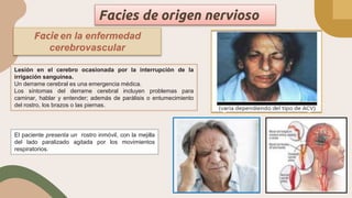 FACIES - MARCHA-NERVIOS CATEDRA DE SEMIOLOÍA | PPTX