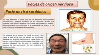 FACIES - MARCHA-NERVIOS CATEDRA DE SEMIOLOÍA | PPTX