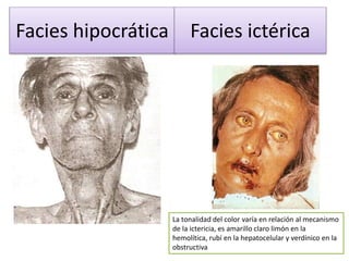 Facies (2) | PPTX