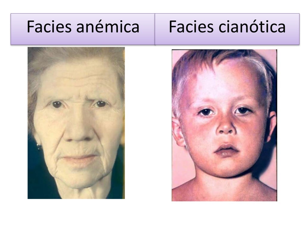 Facies